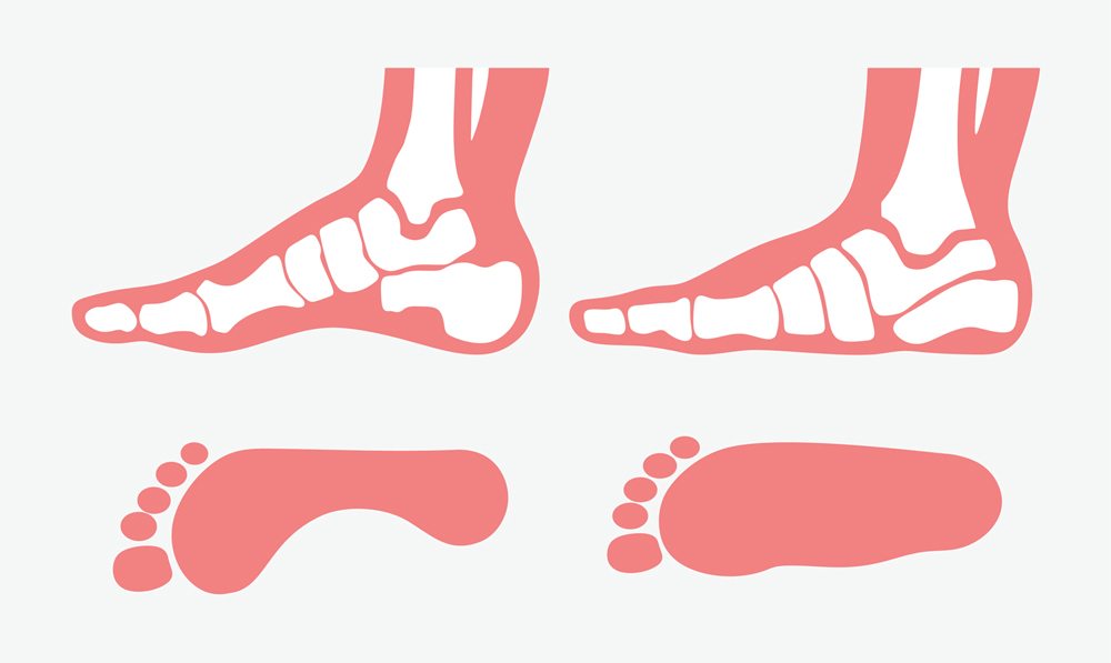 Aká je dobrá detská obuv? Ploché nohy u detí?! | BRENDON